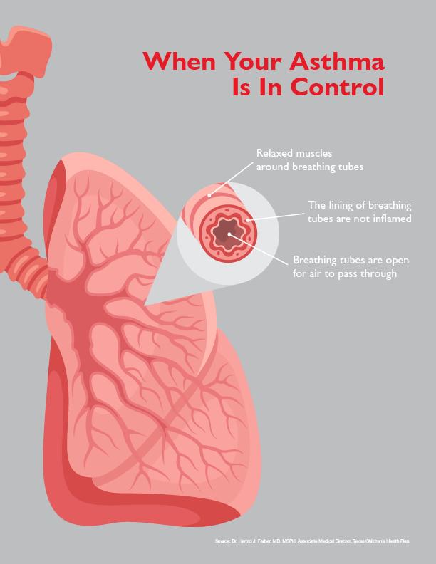 Asthma | Texas Children's Health Plan